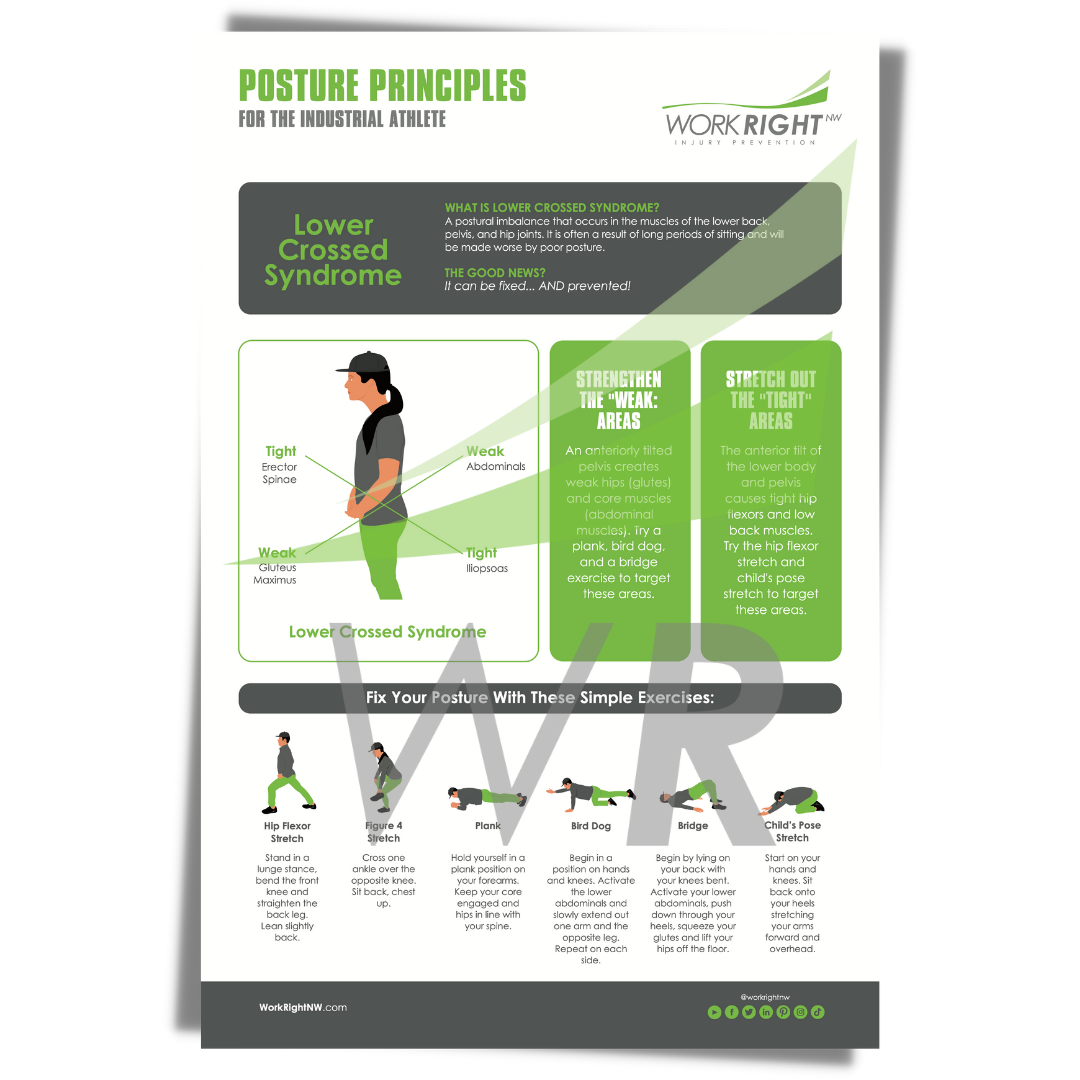 Posture Principles – Lower Crossed Syndrome [Digital Download] – Equip ...